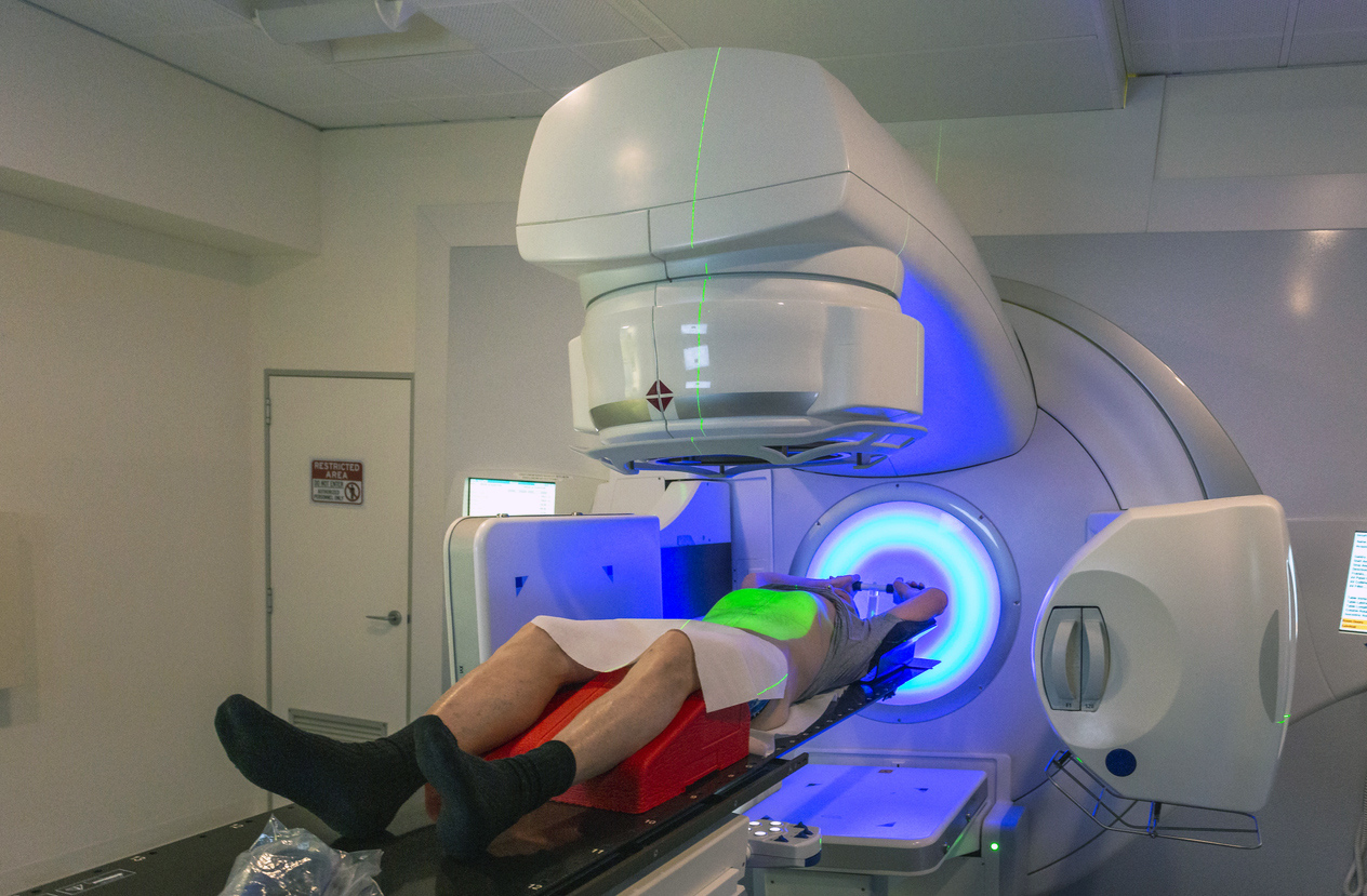 Prostate Cancer Treatment Radiation Prostate Cancer Treatment Radiation